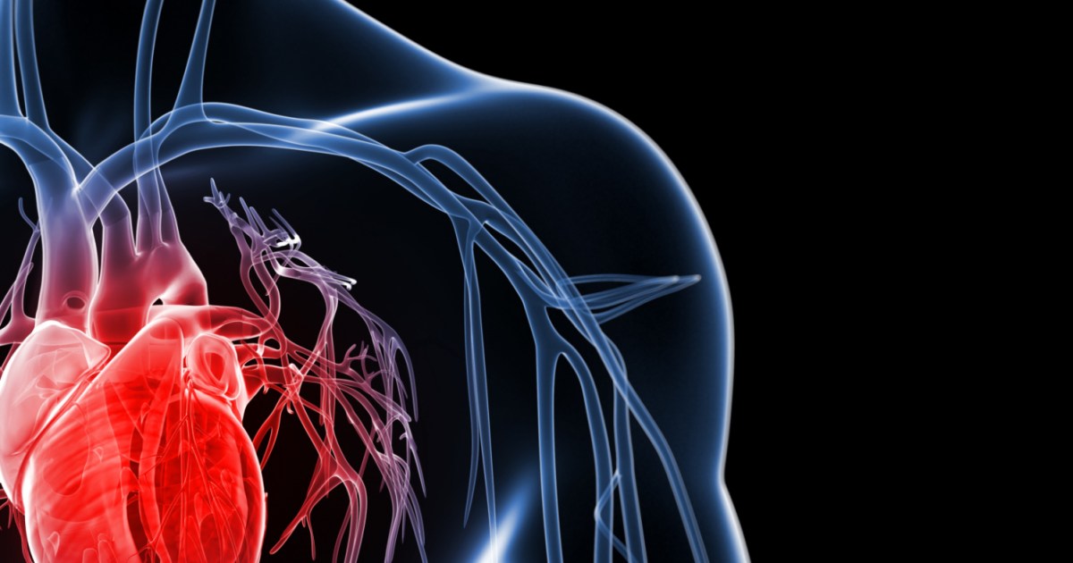 Trop peu de soins en insuffisance cardiaque